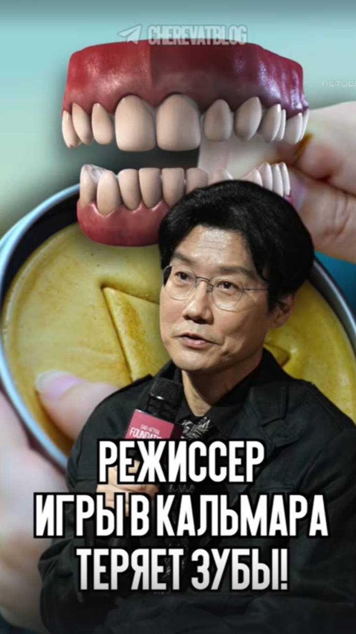 РЕЖИССЕР "ИГРЫ В КАЛЬМАРА" ПОТЕРЯЛ НА СЪЕМКАХ 10 ЗУБОВ
