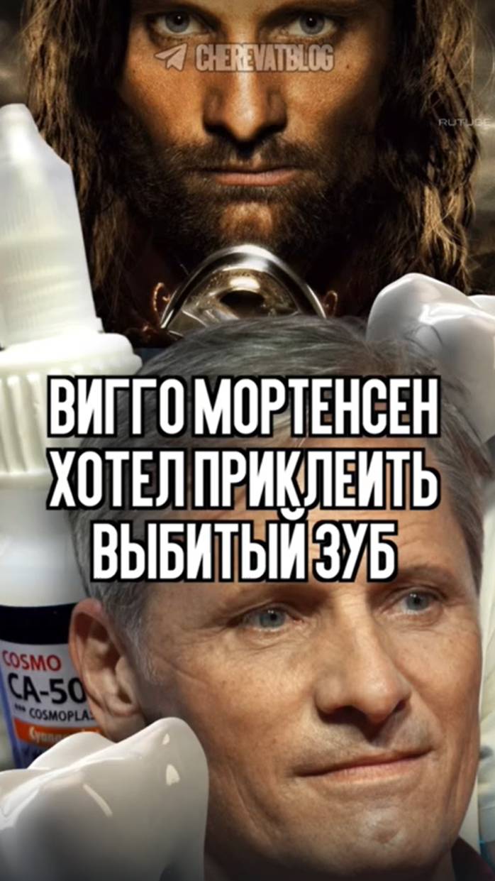 АРАГОРН ПРИКЛЕИЛ ВЫБИТЫЙ ЗУБ И ПРОДОЛЖИЛ СНИМАТЬСЯ