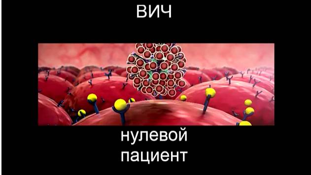 ВИЧ. Нулевой пациент