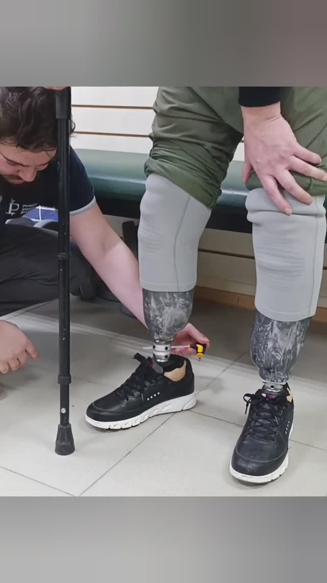 Протезирование при парной ампутации ветерана СВО