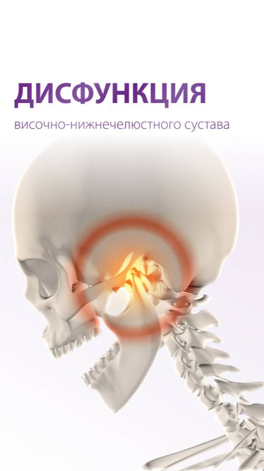 4 пальца между зубами — тест, который может спасти ваш сустав