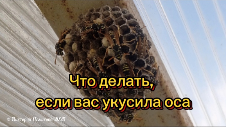 Что делать, если вас укусила оса