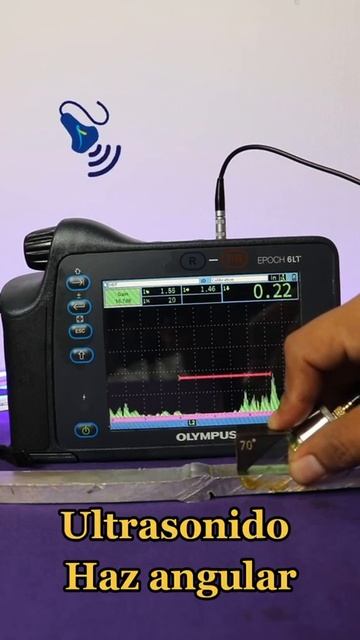 -5687119971681525610