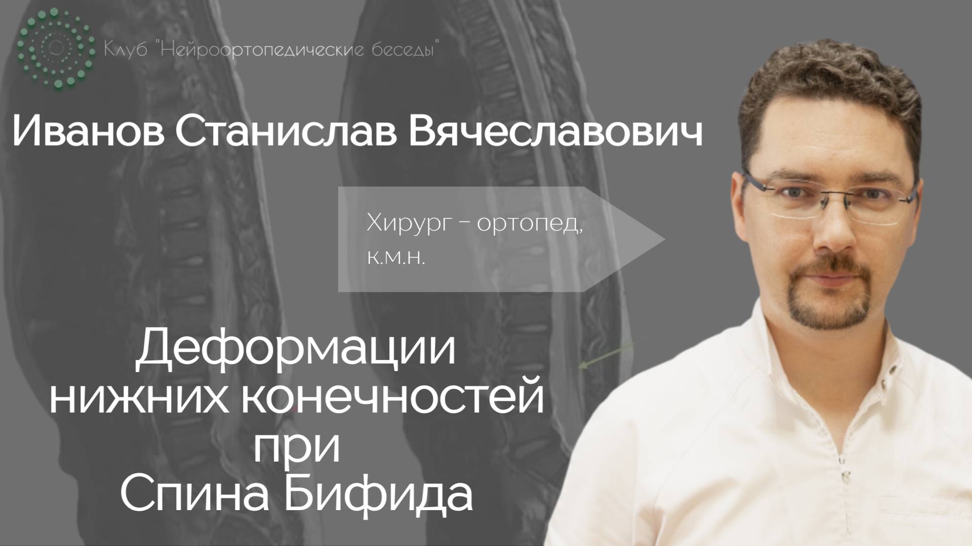 Деформации нижних конечностей при спина бифида