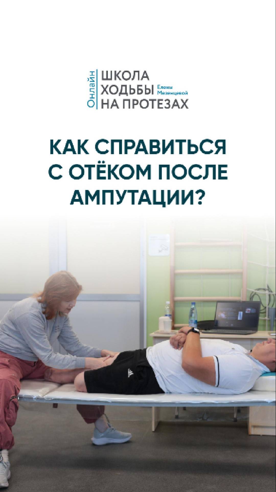 Как справиться с отеком после ампутации