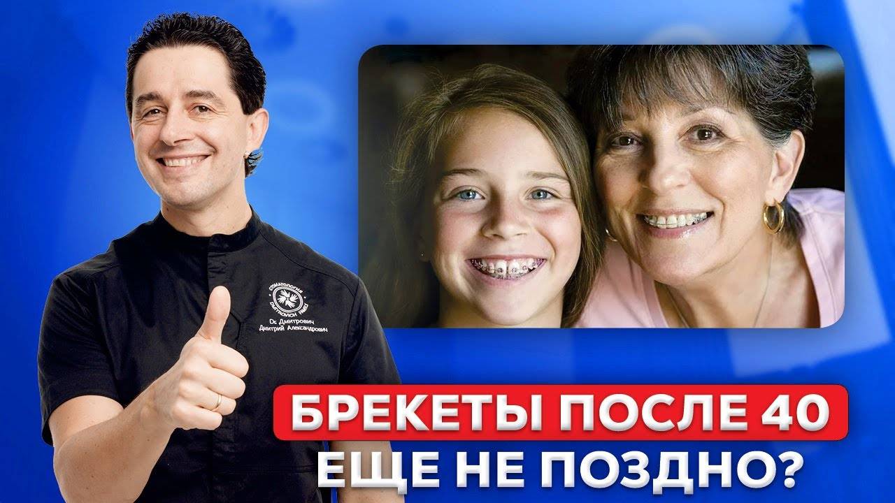 Брекеты после 40 лет — стоит ли начинать?