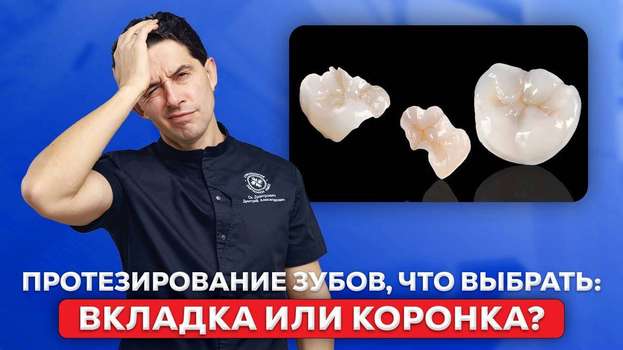 Не Ошибись! Что Лучше для Зуба: Вкладка или Коронка?