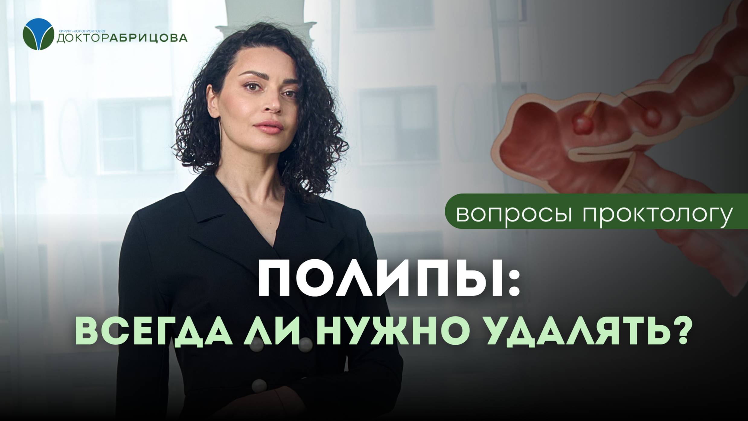 Полипы кишечника: всегда ли нужно удалять? Важные советы проктолога