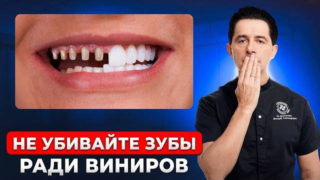 Вред от виниров. Вся правда от стоматолога