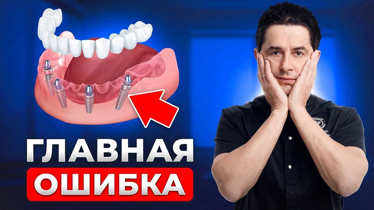 Вся правда про имплантацию ВСЕ-НА-4. Как не остаться без зубов