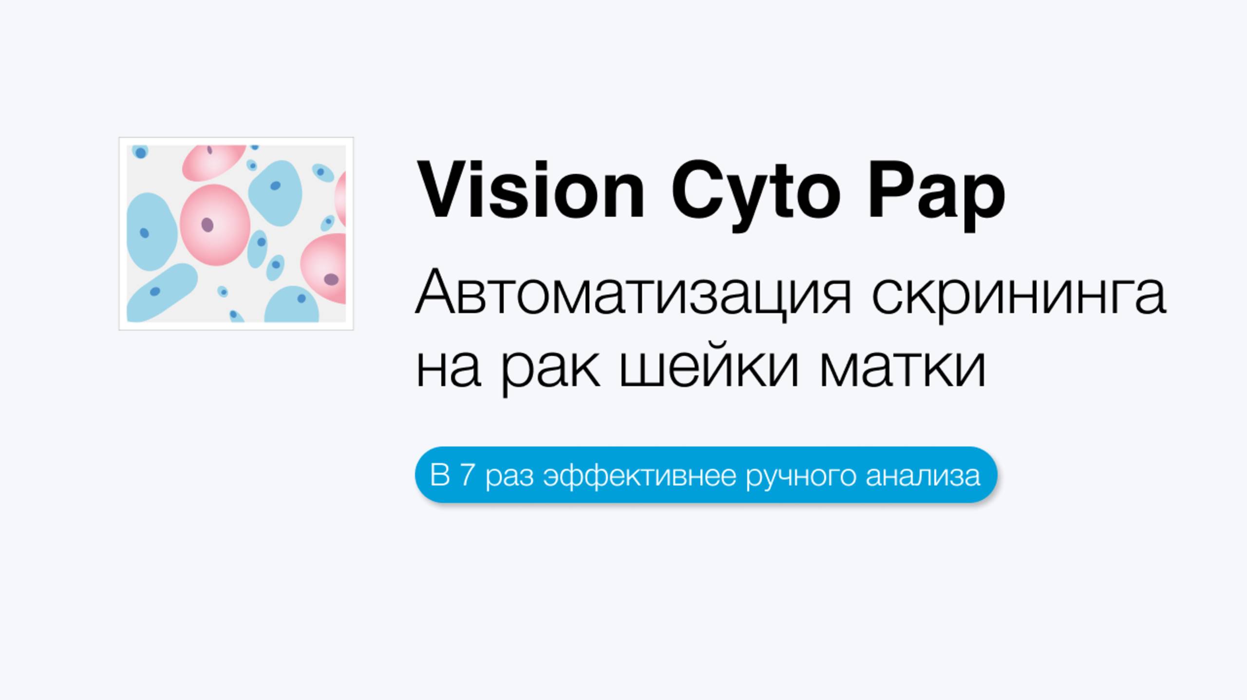 Автоматизация скрининга рака шейки матки | Vision Cyto Pap