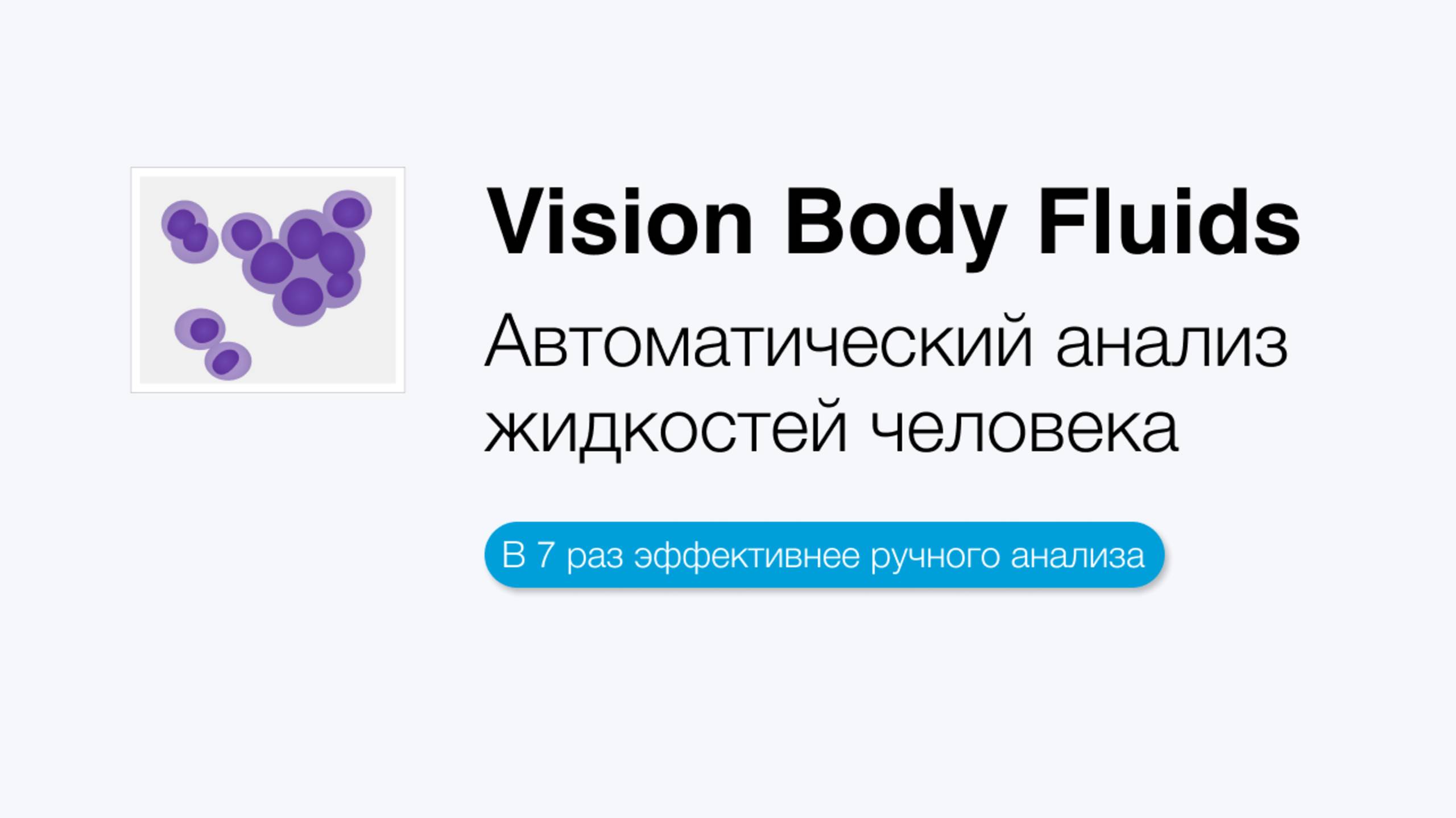 Автоматический анализ жидкостей человека | Vision Body Fluids