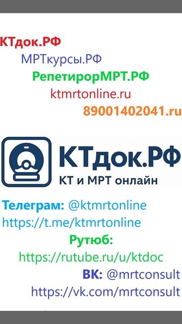 Лептоменингеальный канцероматоз