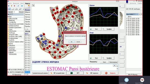 2 - Дианел-Про обучение биорезонансной диагностике