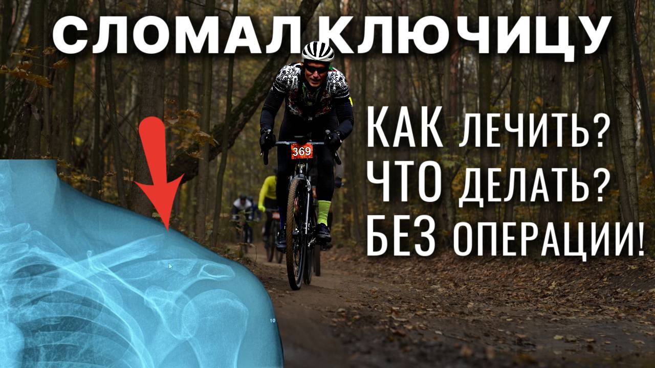 ПЕРЕЛОМ КЛЮЧИЦЫ / УПРАЖНЕНИЯ ДЛЯ ВОССТАНОВЛЕНИЯ / ТОМИЛИНСКИЙ веломарафон / 1 место МВМ 2024