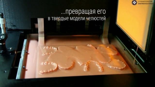 Процесс изготовления Элайнеров VSD