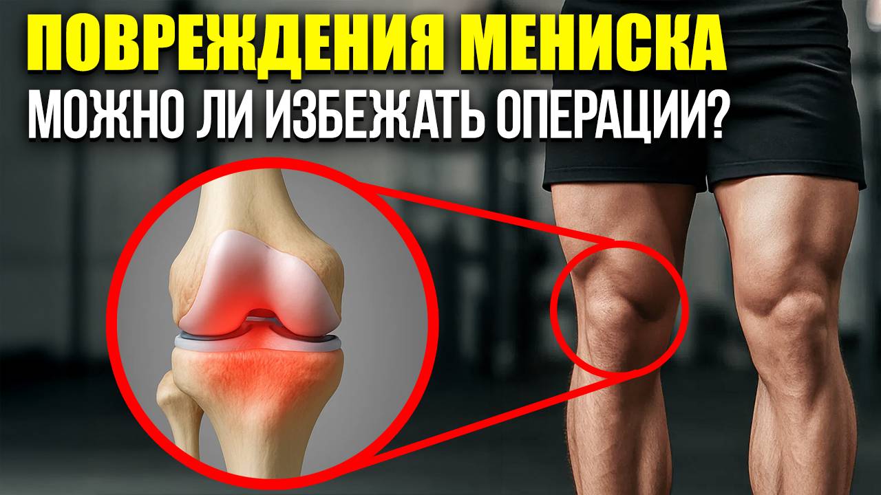 🔥 Консервативное лечение повреждения мениска – можно ли избежать операции?