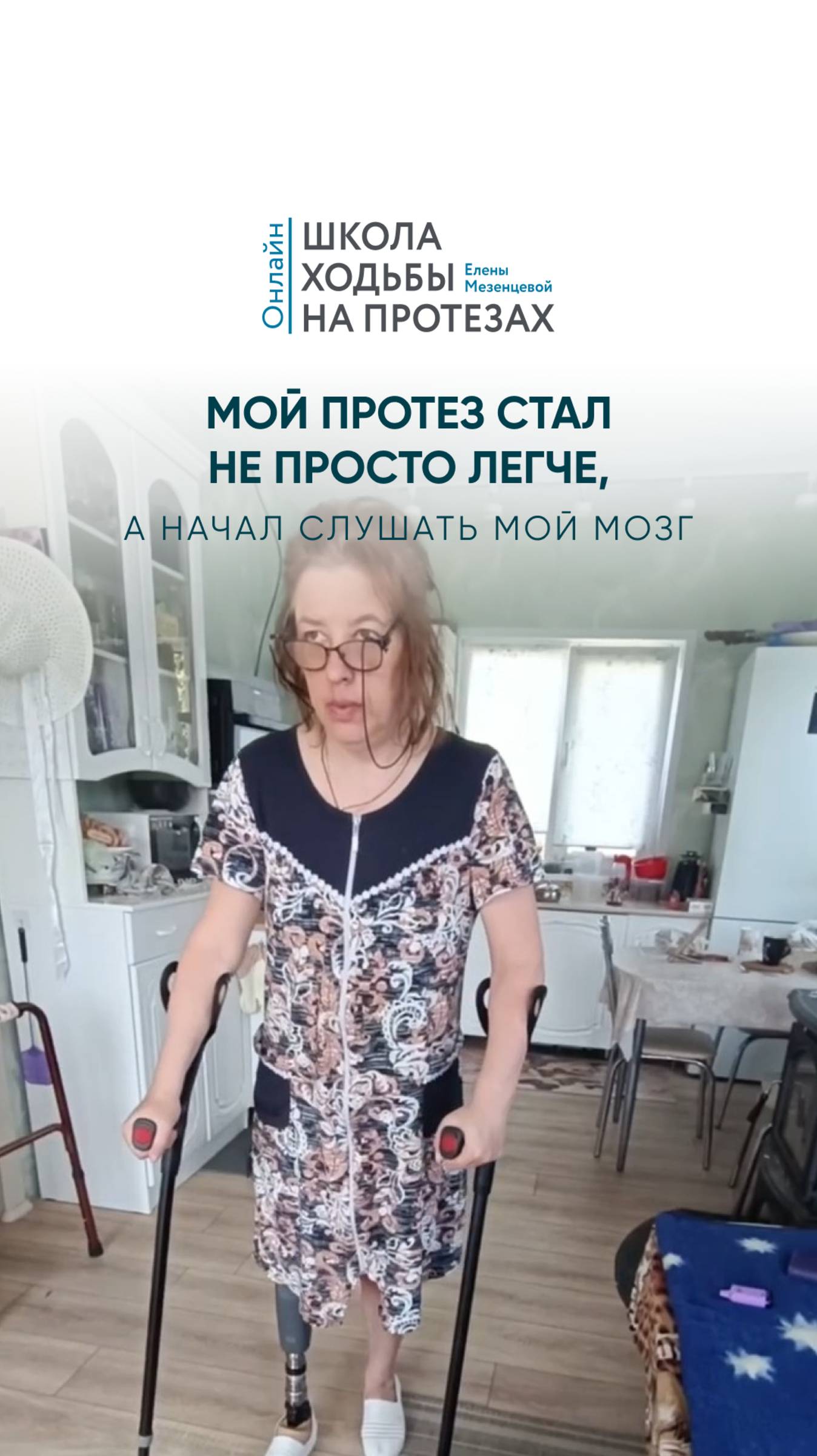 Мой протез стал слушать мой мозг