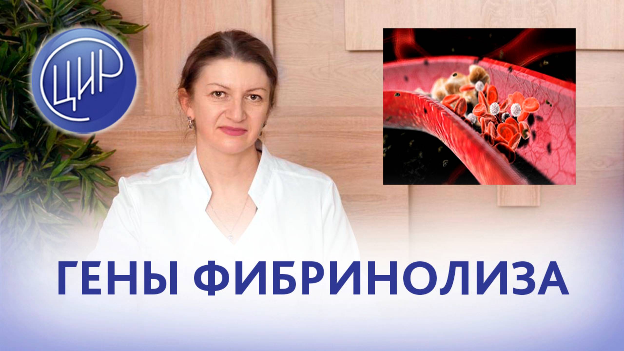 Гены фибринолиза и проблемы, которые они могут вызывать. Дементьева С.Н.