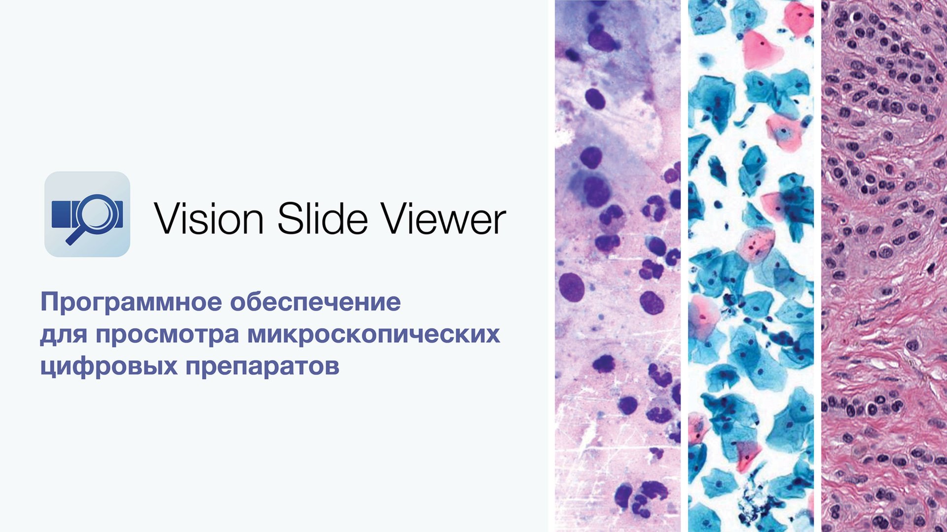Просмотр цифровых препаратов | Vision Slide Viewer