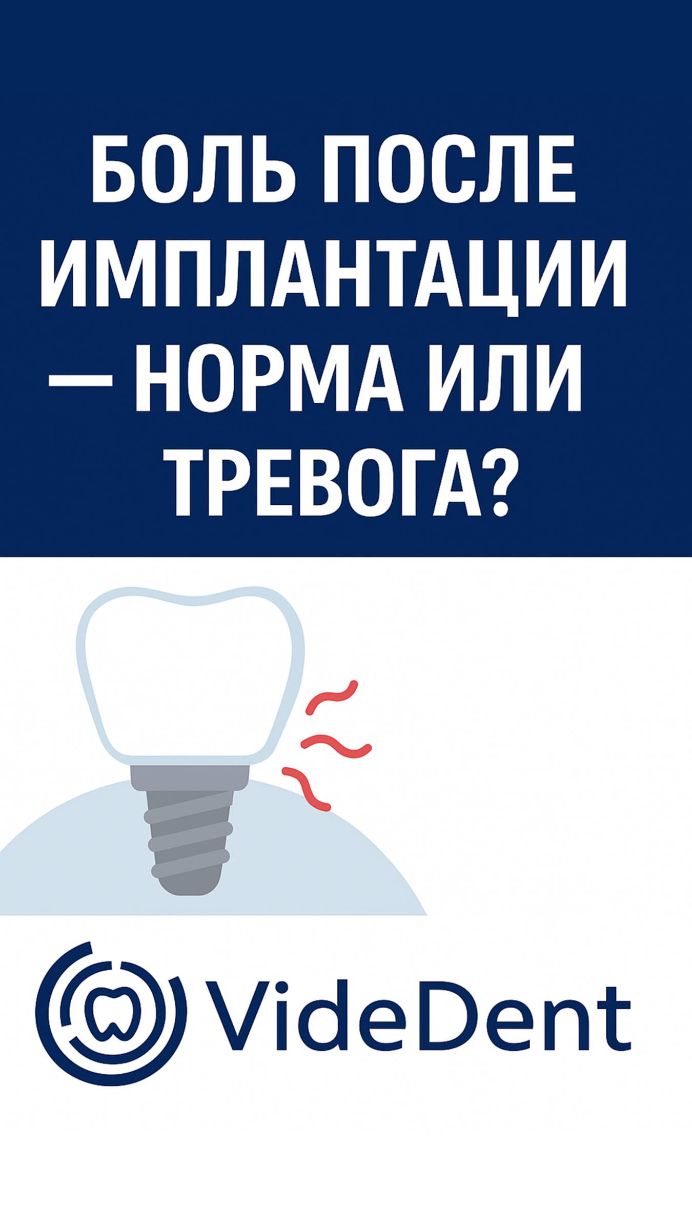 Почему болят зубы после имплантации? Причины и решения #имплантациязубов #больпослеимплантации