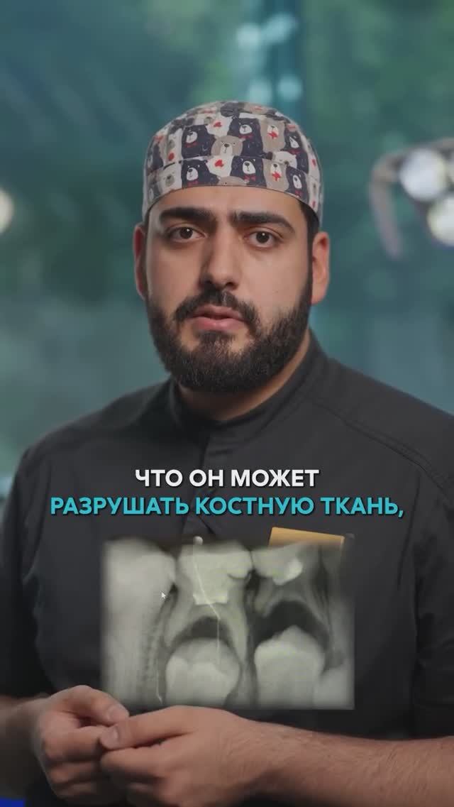 Лечение периодонтита молочных зубов