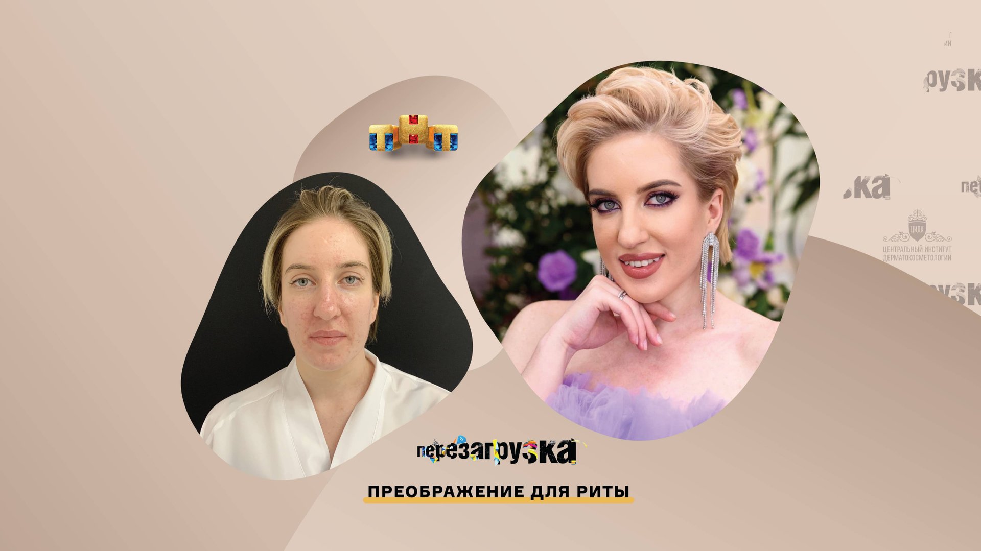 Перезагрузка Риты в ЦИДК.  История борьбы с акне.