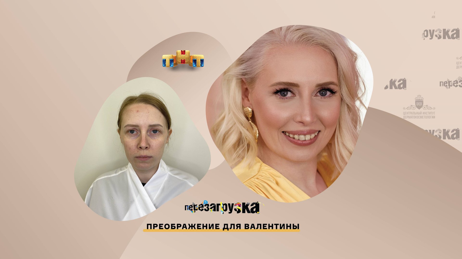 Преображение Валентины на проекте Перезагрузка