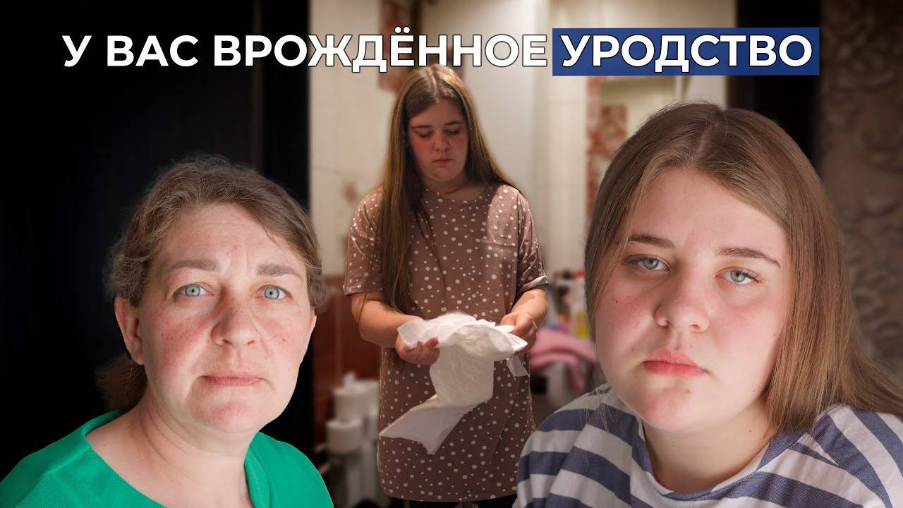 ЭКСТРОФИЯ МОЧЕВОГО ПУЗЫРЯ | История Наташи Вернер