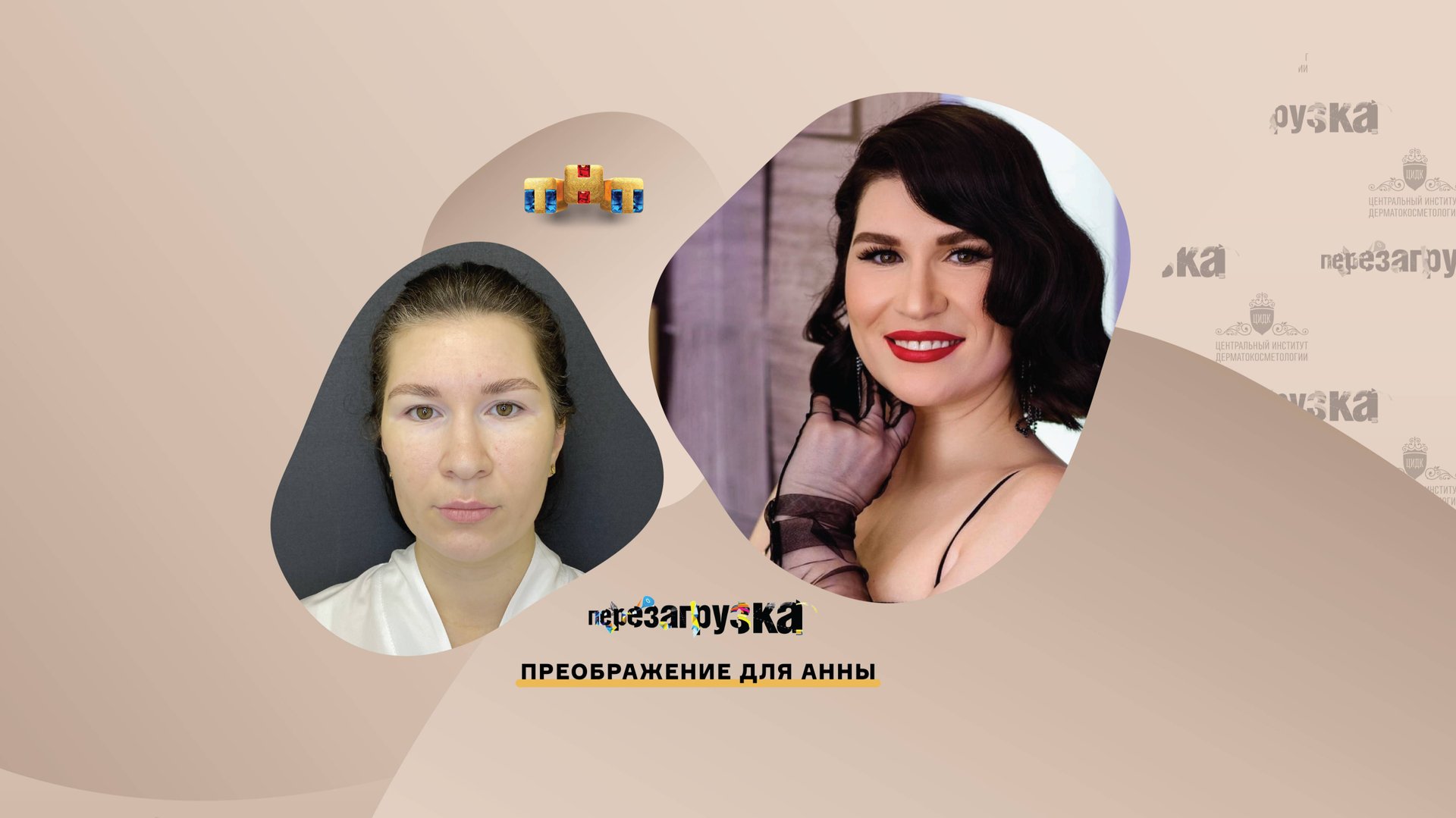 Процедуры у косметолога для Анны из проекта "Перезагрузка" на телеканале ТНТ