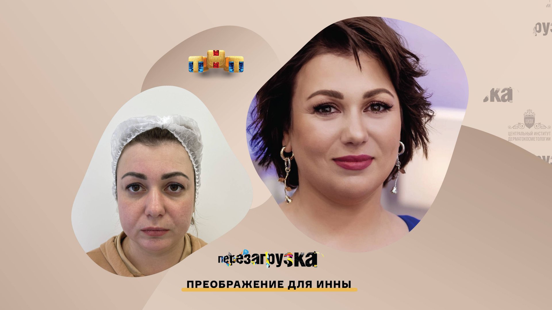 Перезагрузка Инны Нестеровой в ЦИДК