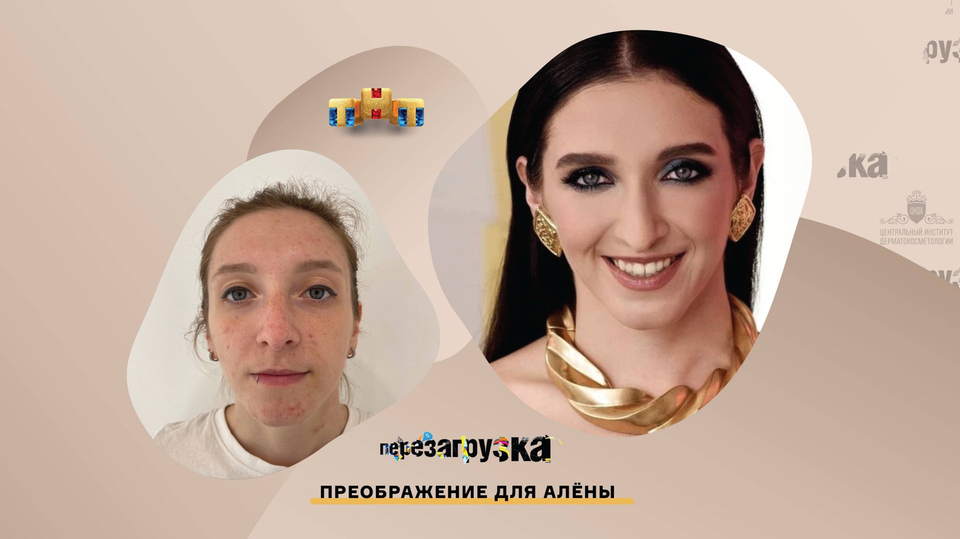 Преображение Алены "Рамоны" Ледаковой в ЦИДК