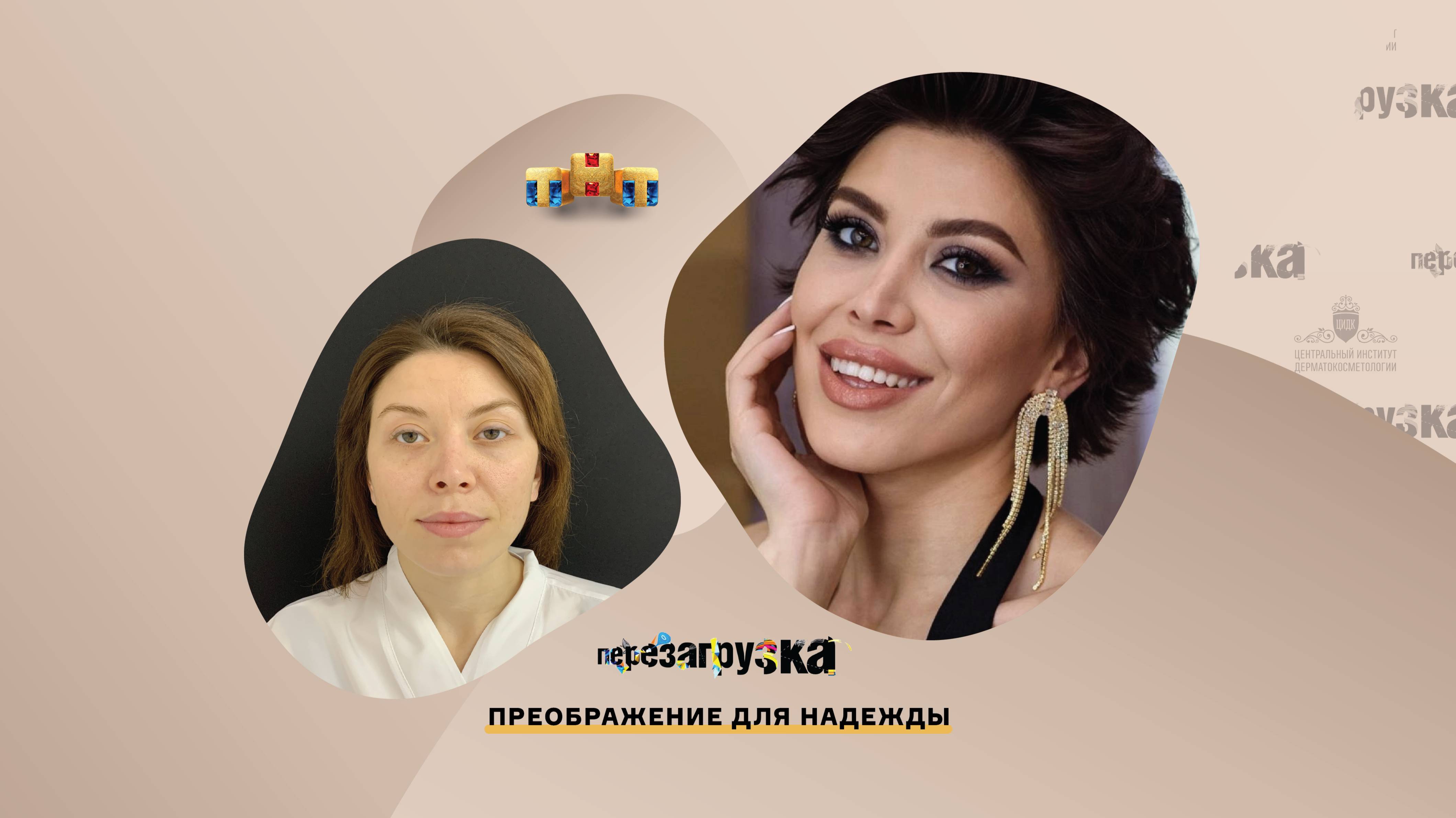 Перезагрузка Нади в ЦИДК