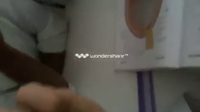 Анатомия  органа  зрения  разбор на занятии