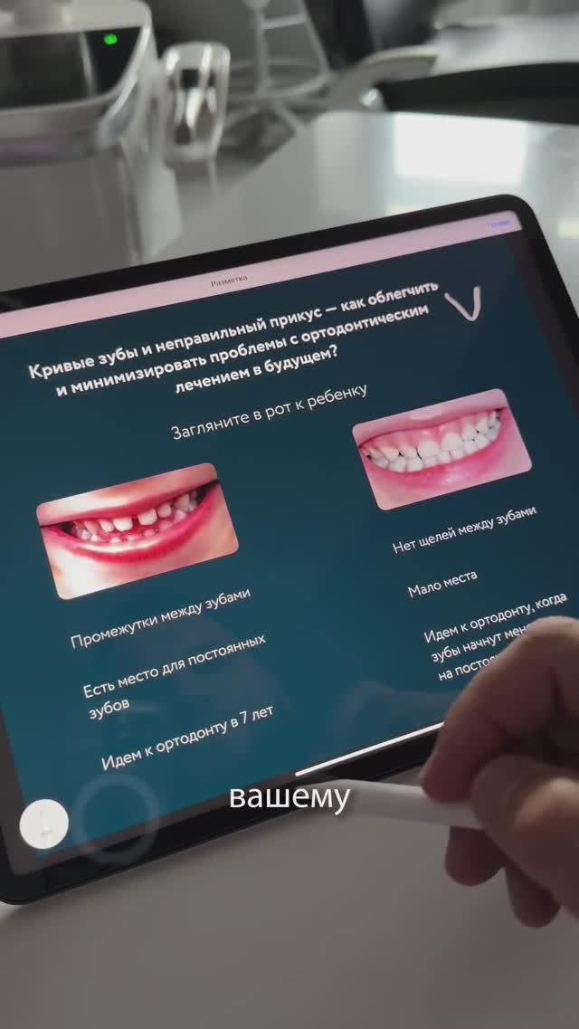 Кривые зубы и неправильный прикус - как этого избежать?