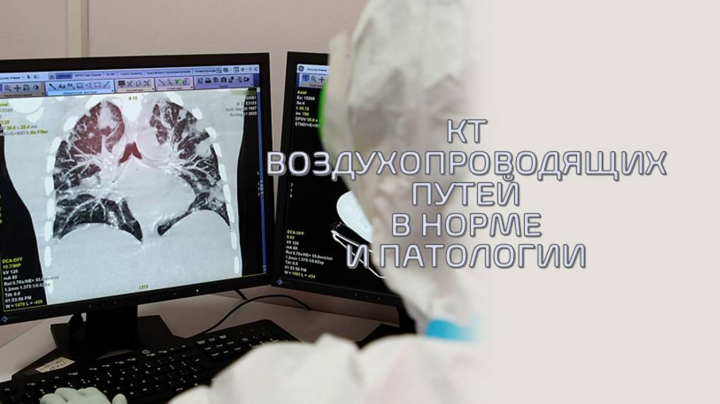 Компьютерная томография воздухопроводящих путей в норме и патологии