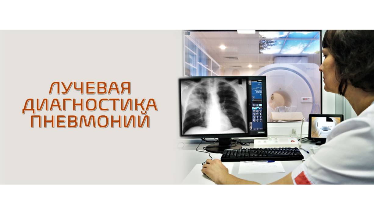 ЛУЧЕВАЯ ДИАГНОСТИКА ПНЕВМОНИЙ