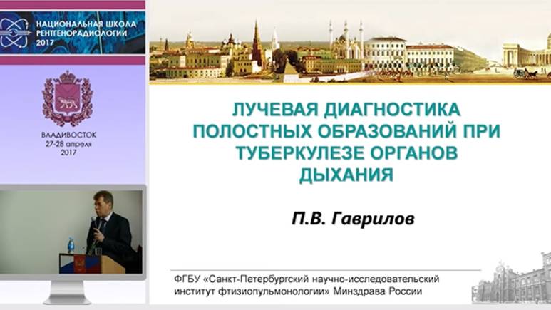 Лучевая диагностика полостных образований при туберкулезе органов дыхания