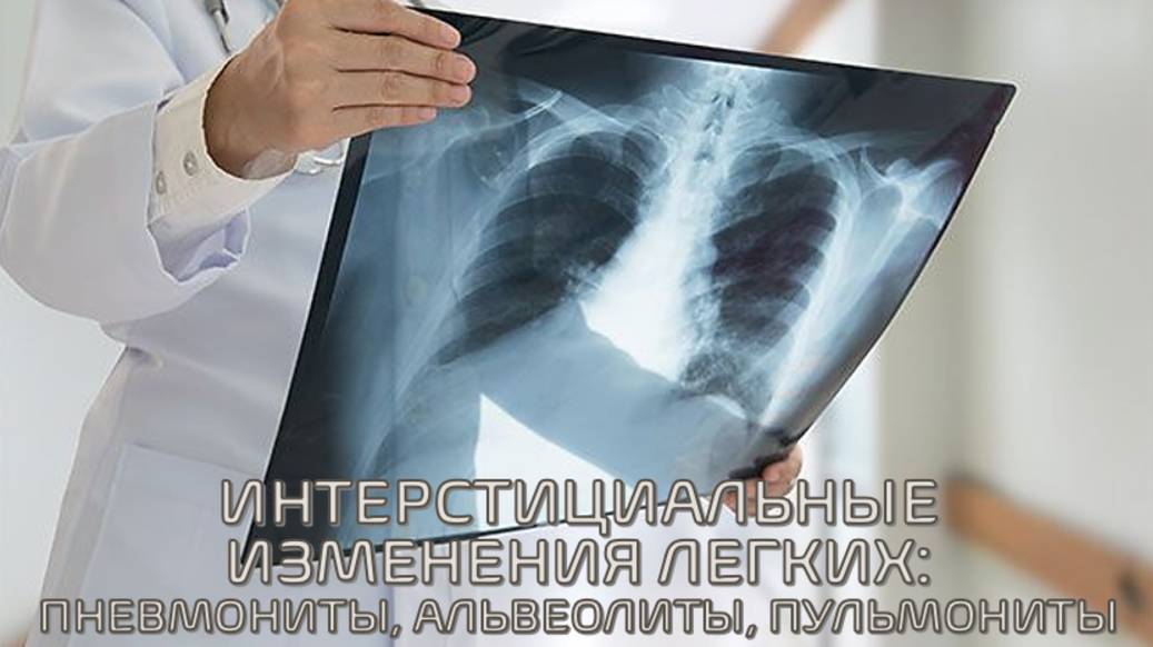 Интерстициальные изменения легких - пневмониты, альвеолиты, пульмониты