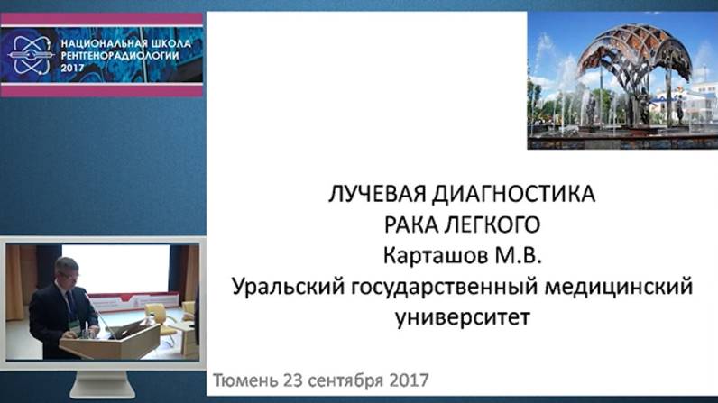 Лучевая диагностика рака легкого