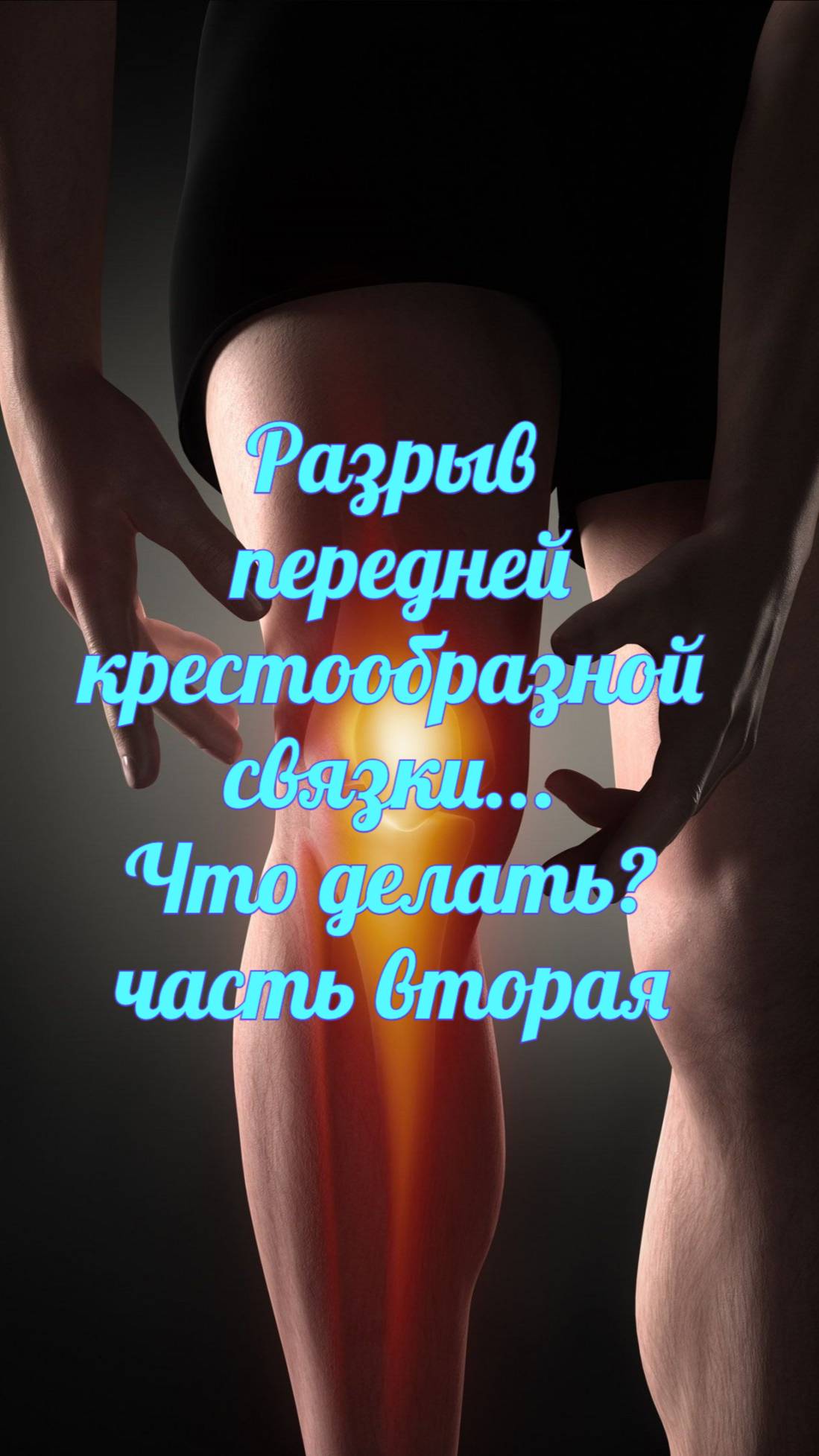 Разрыв передней крестообразной связки. Что делать? часть вторая