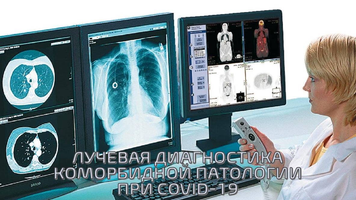 Лучевая диагностика коморбидной патологии при COVID-19