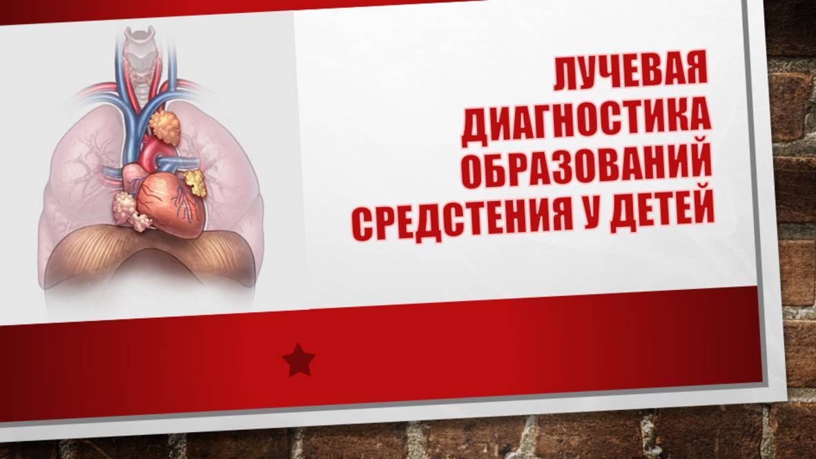 Лучевая диагностика образований средостения у детей