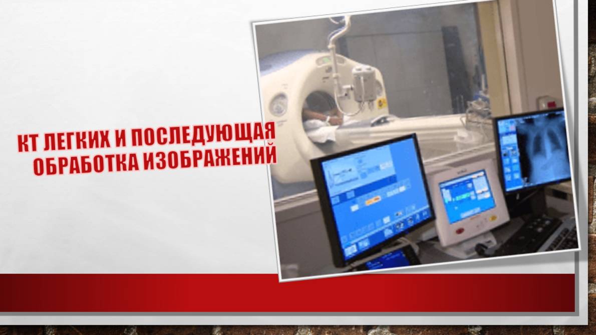 КТ легких и последующая обработка изображений