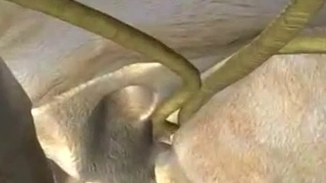 АНАТОМИЯ  ОРБИТЫ  экскурсия Pares craneales