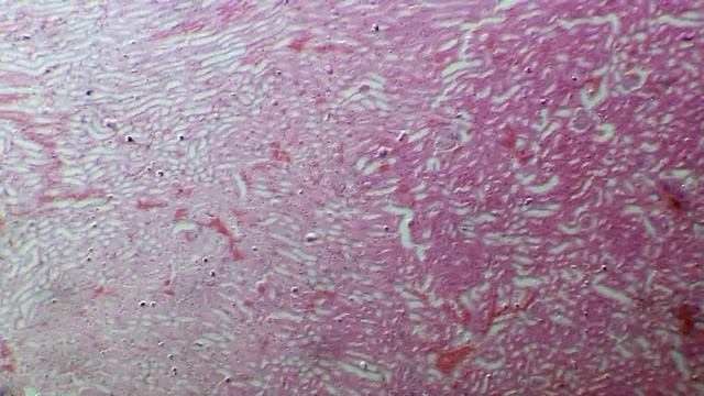 Продольный разрез почки под микроскопом