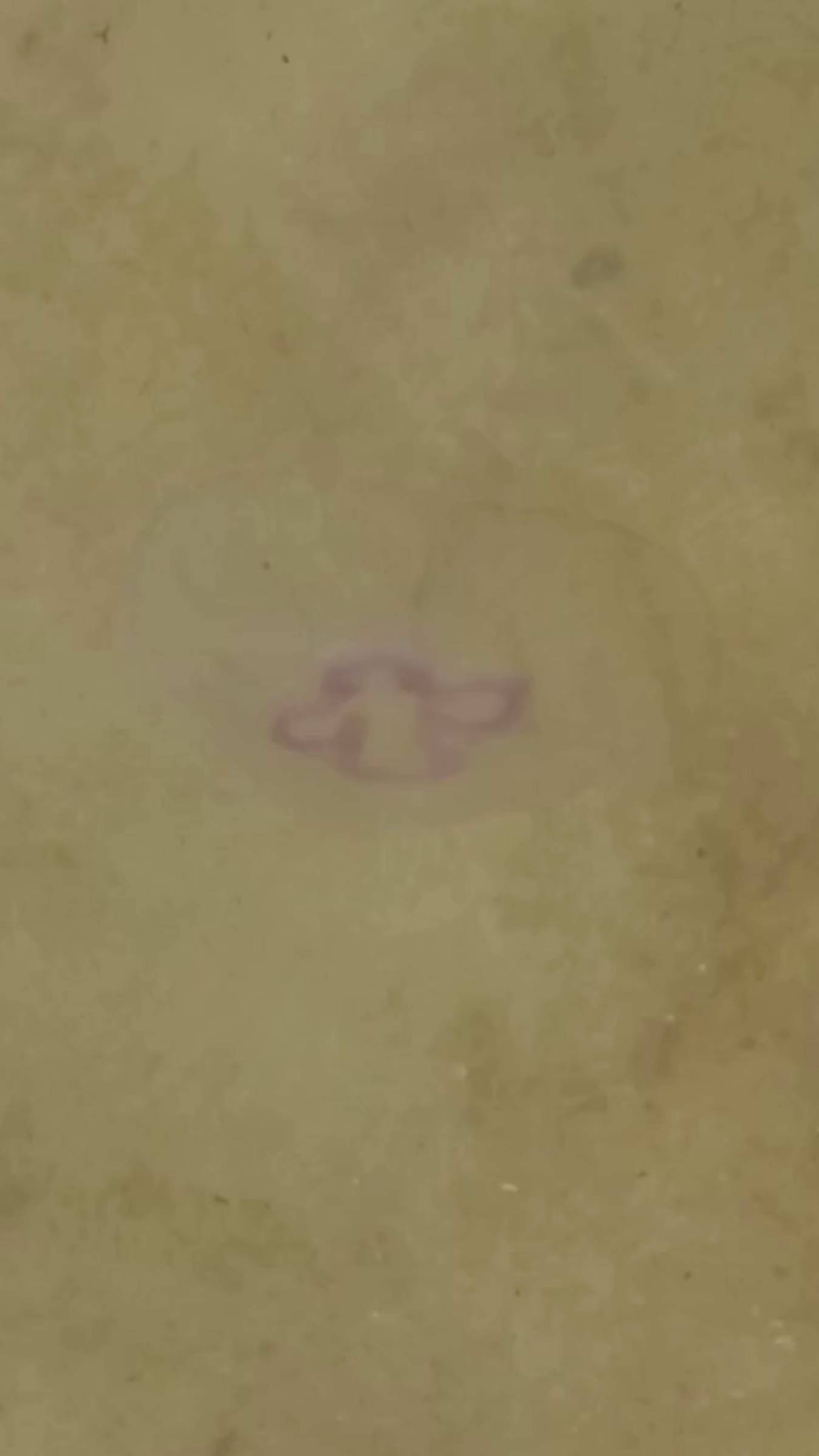 Медуза. Встреча на море с медузой) Близкая съемка #STR