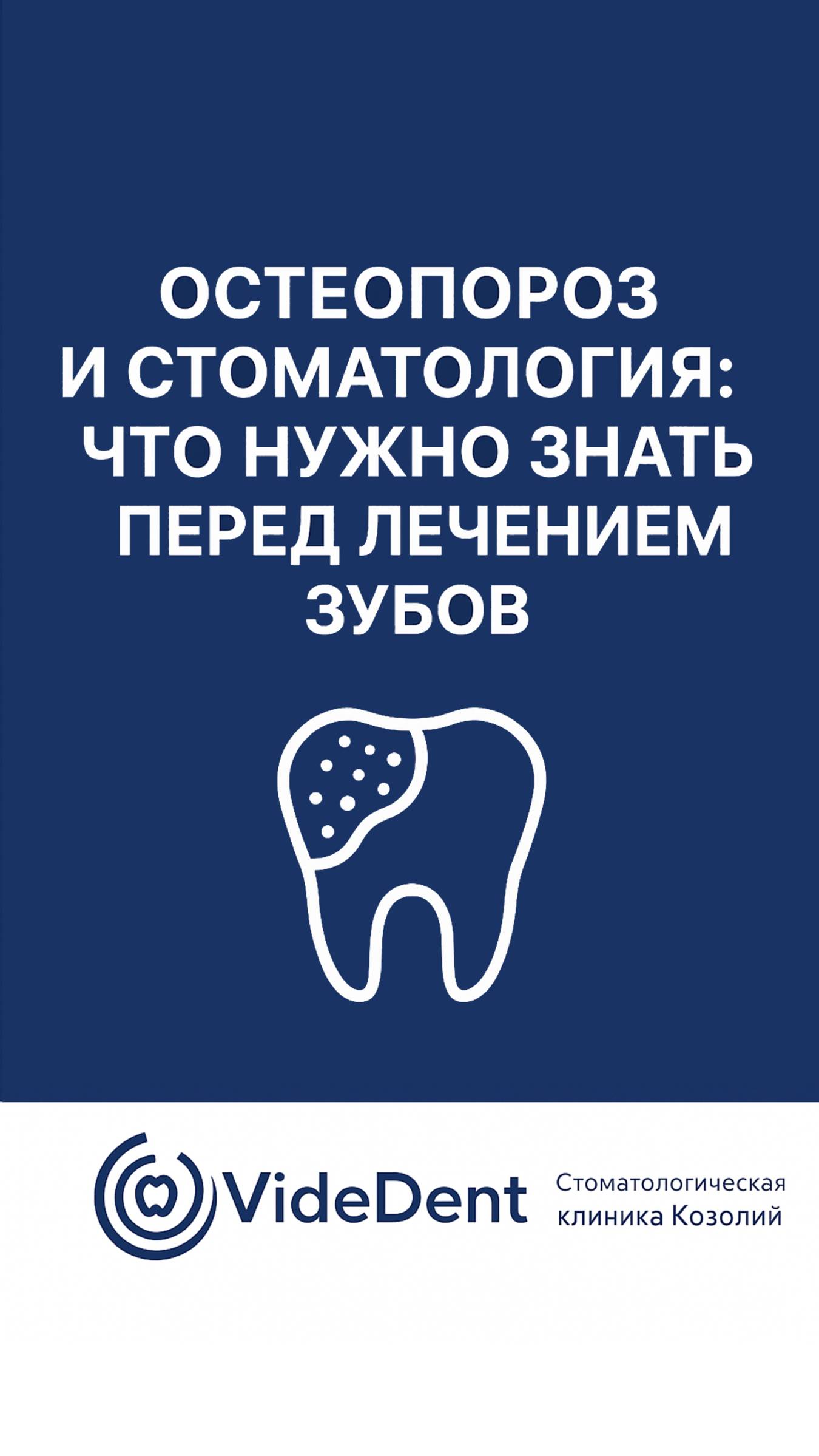 Остеопороз и стоматология — что нужно знать перед лечением зубов#остеопороз #стоматология #здоровье