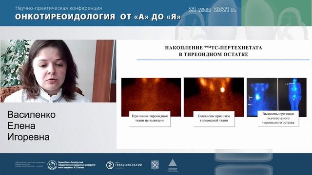 Лекция: «Радиойодтерапия пациентов с ВДРЩЖ: показания, подготовка, осложнения»