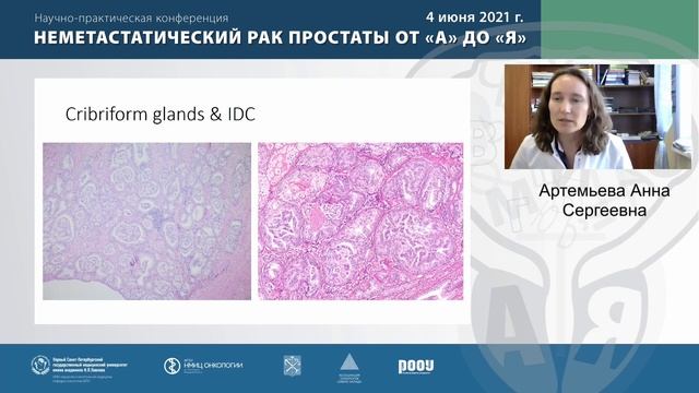 Лекция: «Динамика развития представлений о морфологии рака простаты»